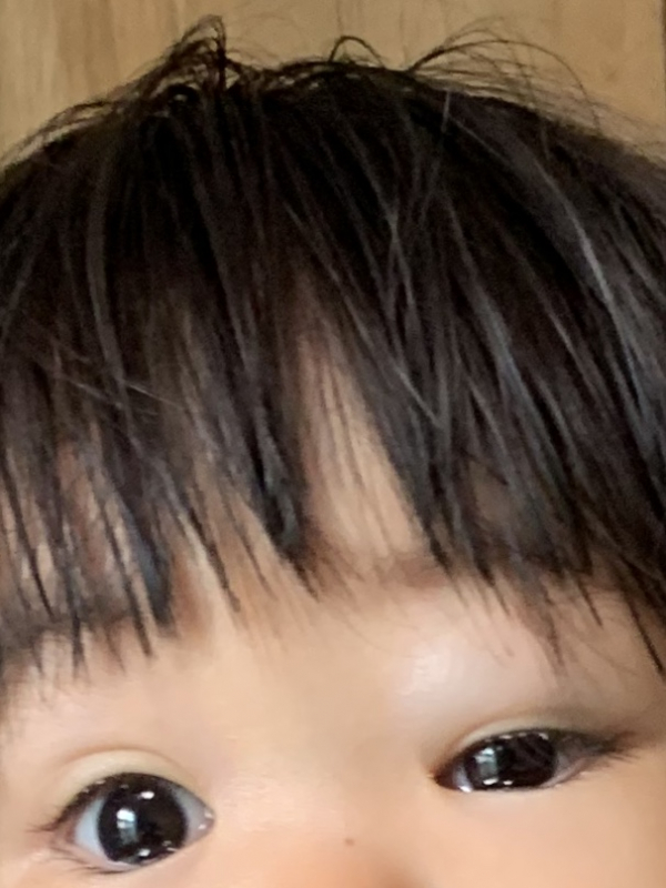 1歳半の子供です。【赤ちゃんの病気・ケガ】｜ベビーカレンダー専門家相談