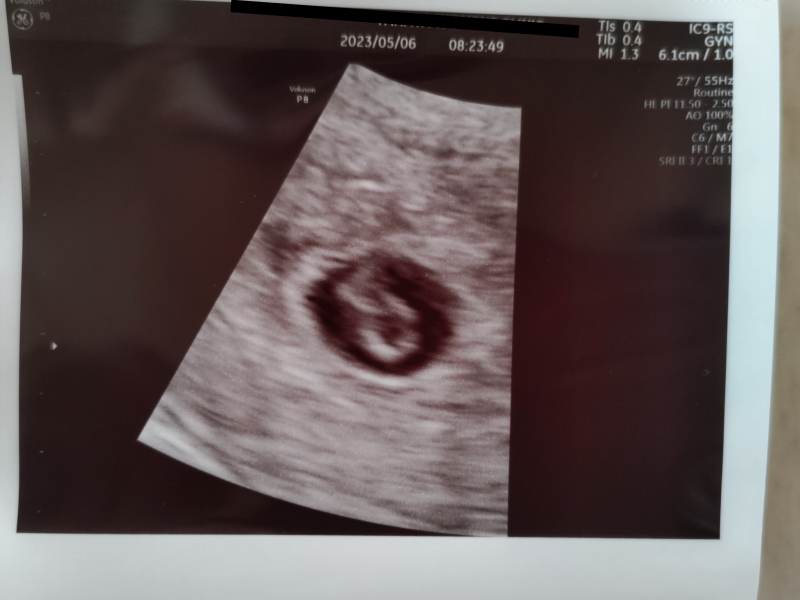 7w6d 出血あり 心拍確認＋｜医療専門家が個別回答 妊娠・出産・子育ての悩みを解決するオンライン相談｜ベビーカレンダー